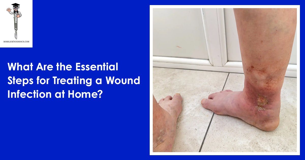 How to Treat Wound Infection at Home? - mobilewounddocs.com