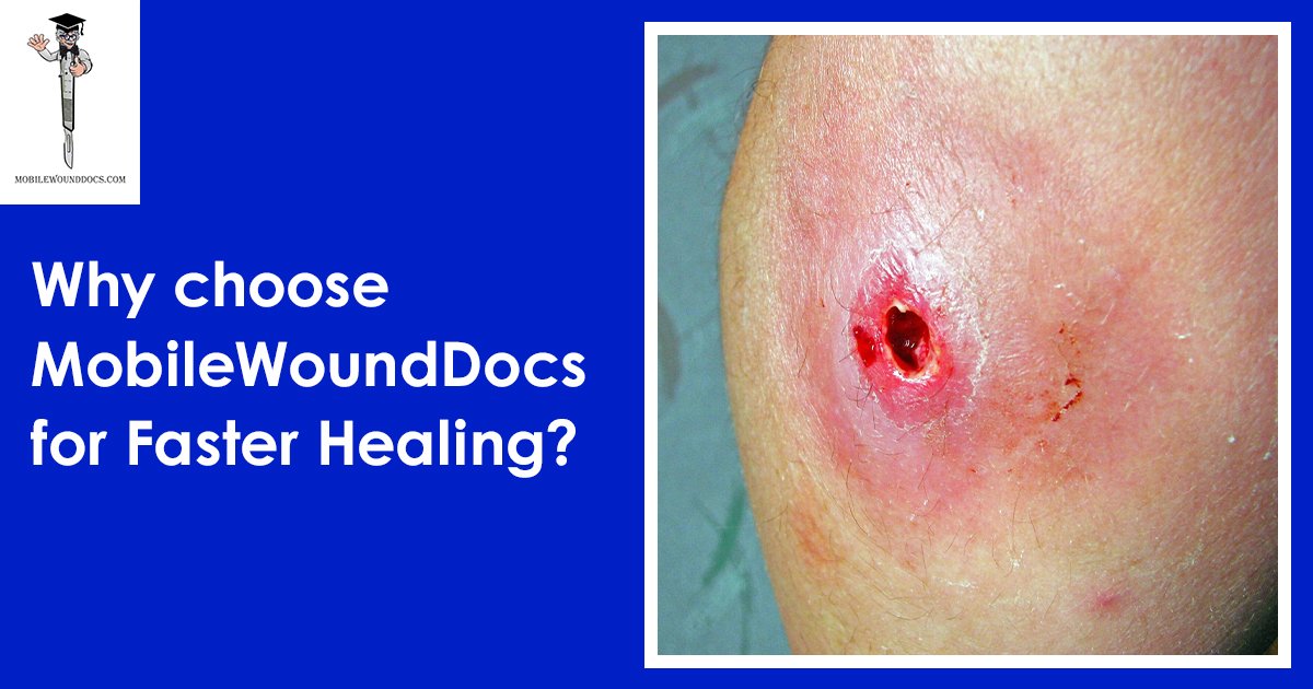 How to Help Your Open Wounds Heal Faster? - mobilewounddocs.com